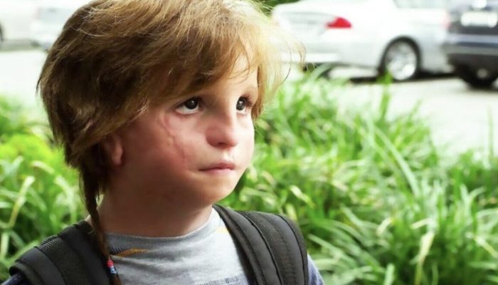 Who is the kid from the film "Wonder" what does he resemble without ...