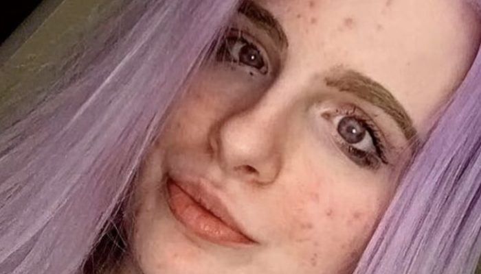 Everyone was surprised when the girl opened her eyes because no one had ...